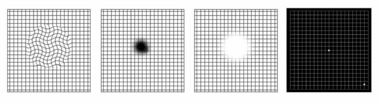 Cos'è e come si effettua il test della griglia di Amsler - Vision Future